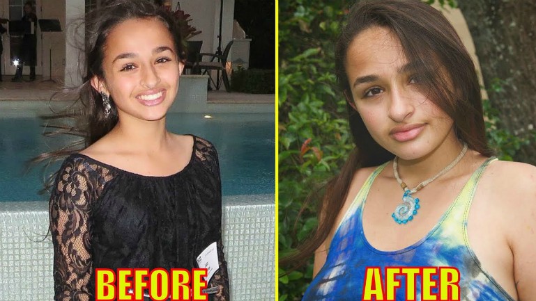 Jazz Jennings Surgery